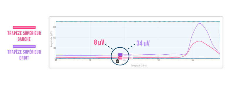 Qu'est-ce que l'excès de tonus musculaire | 3 façons de le mesurer