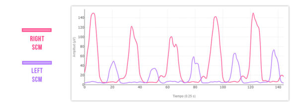 Limited Cervical Rotation | 2 Formulas to Identify the Problem