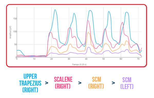 Definitive Guide | Muscle Synergies | Cervical Lateral Flexion