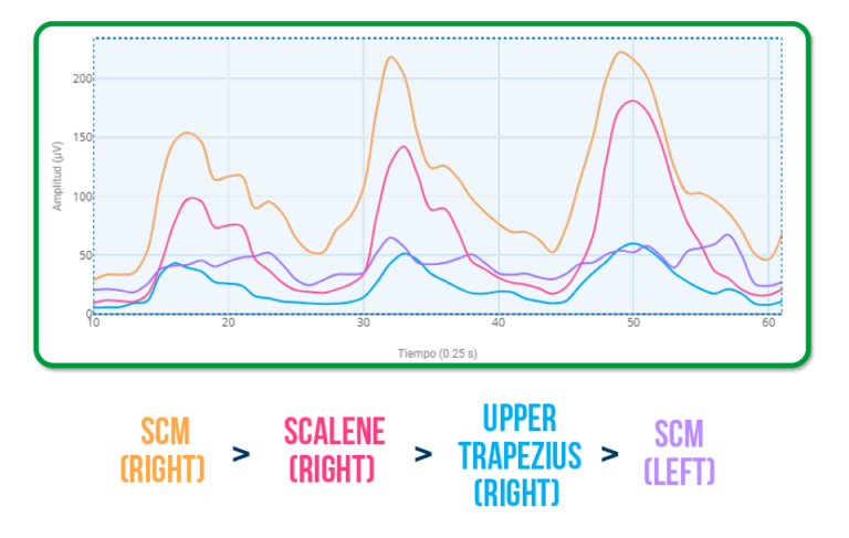 Definitive Guide | Muscle Synergies | Cervical Lateral Flexion