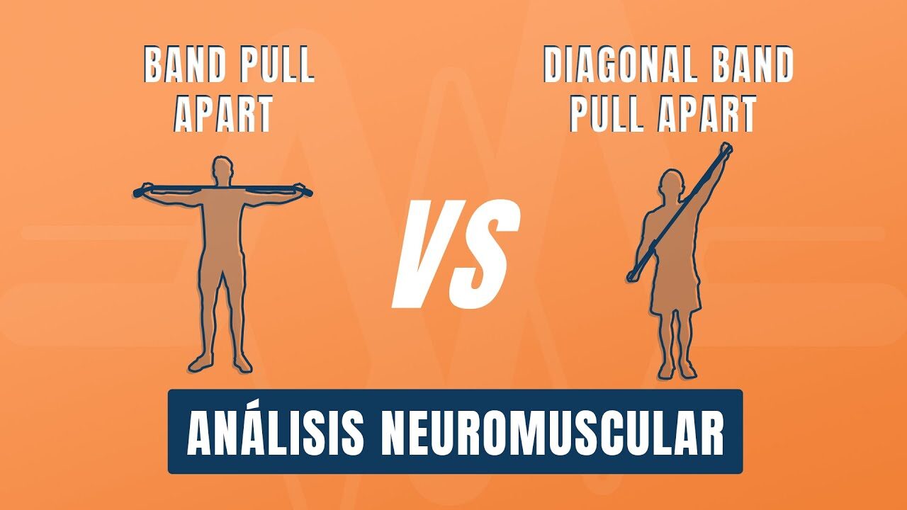 Análisis neuromuscular | Band pull vs diagonal band pull [+VIDEO]
