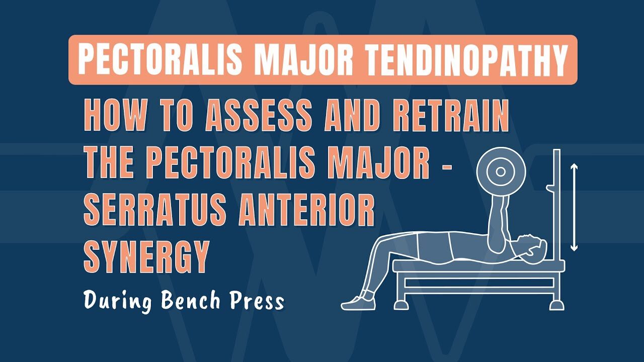 Pectoralis Major Tendinopathy | How to Assess and Retrain