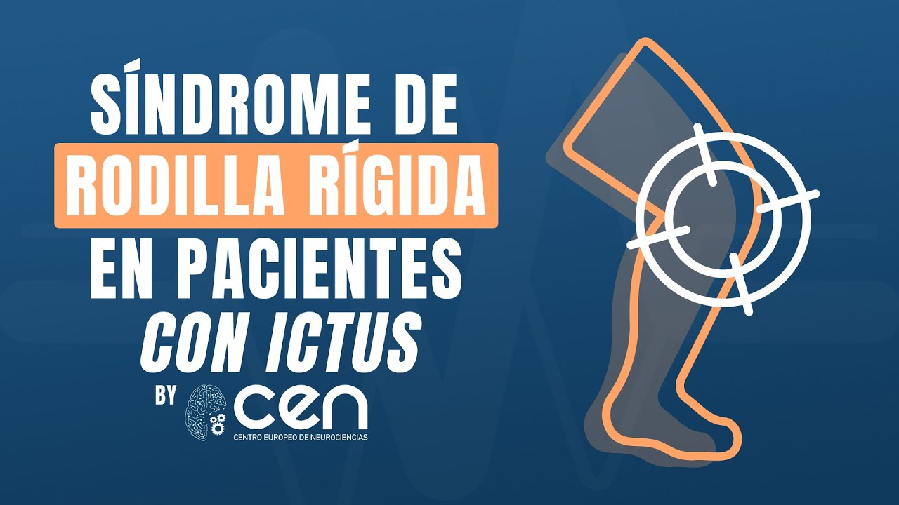 Síndrome de la rodilla rígida en pacientes con ictus [+VIDEO]